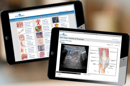 SonoSim - Ultrasound Training Solution